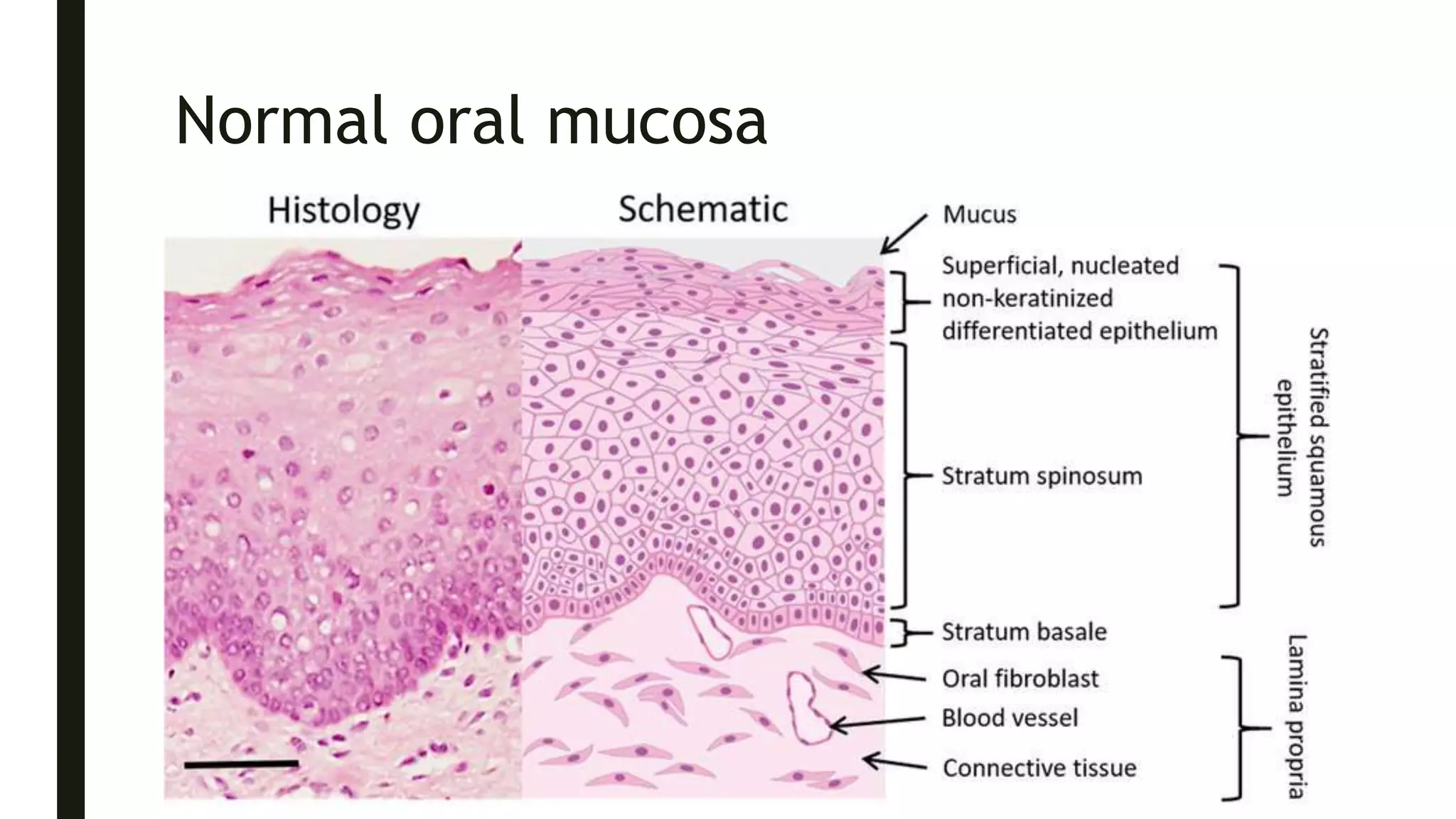 RED AND WHITE LESIONS OF THE ORAL MUCOSA.pptx