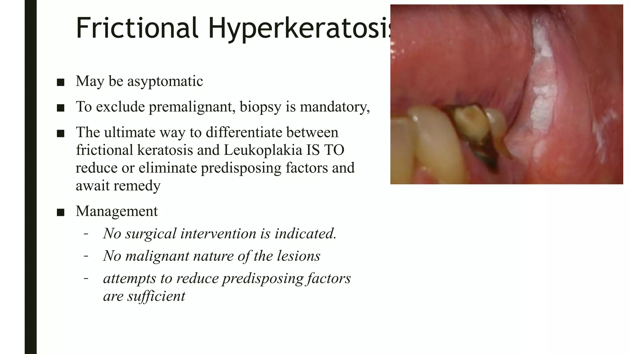 RED AND WHITE LESIONS OF THE ORAL MUCOSA.pptx
