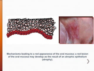 red and white part1 in oral medicine.pptx