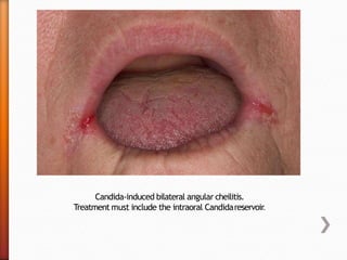 red and white part1 in oral medicine.pptx