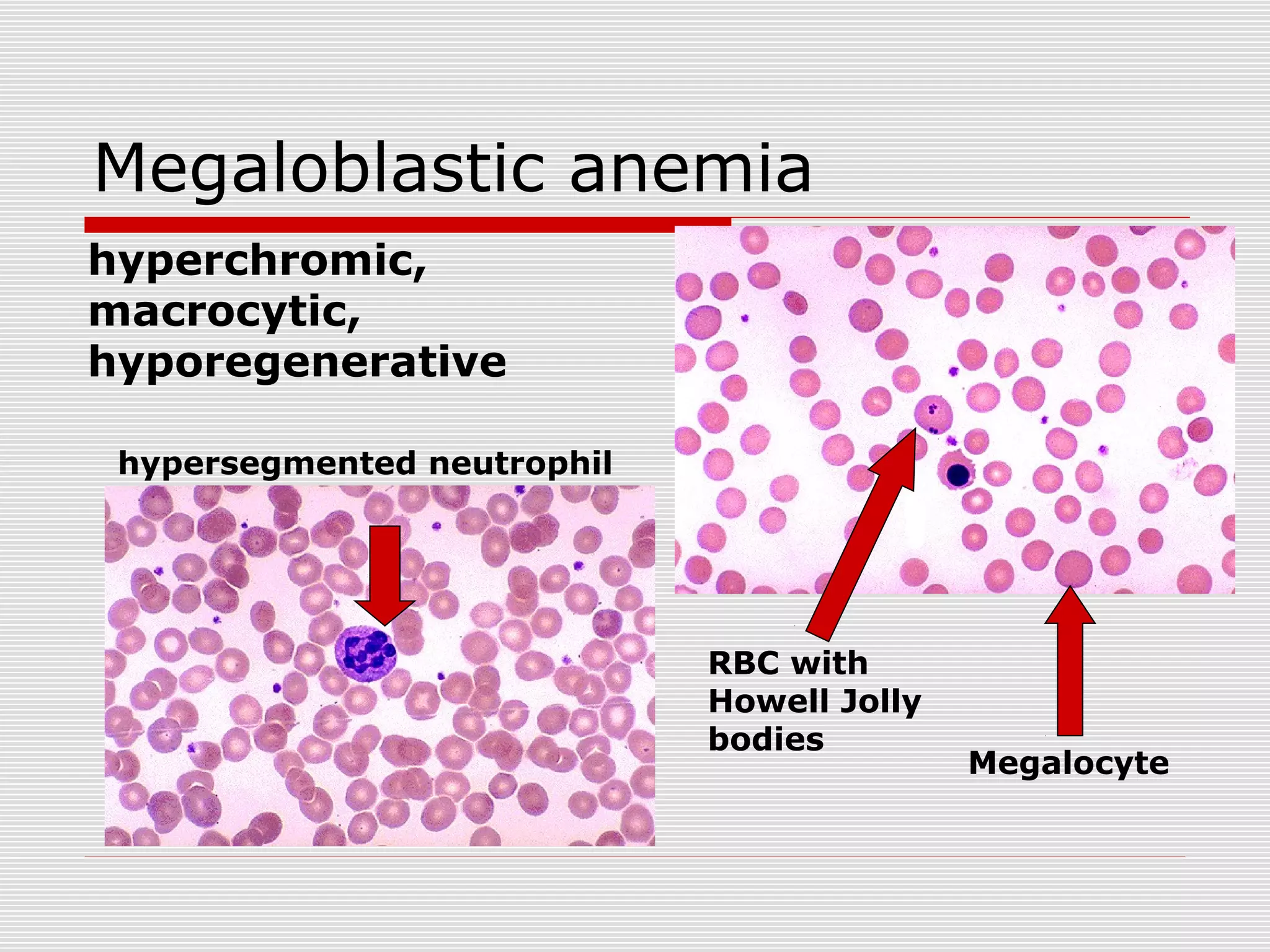 Red Blood cell pathology | PPT