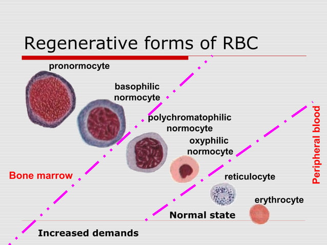 Red Blood cell pathology | PPT | Blood Disorders | Diseases and Conditions