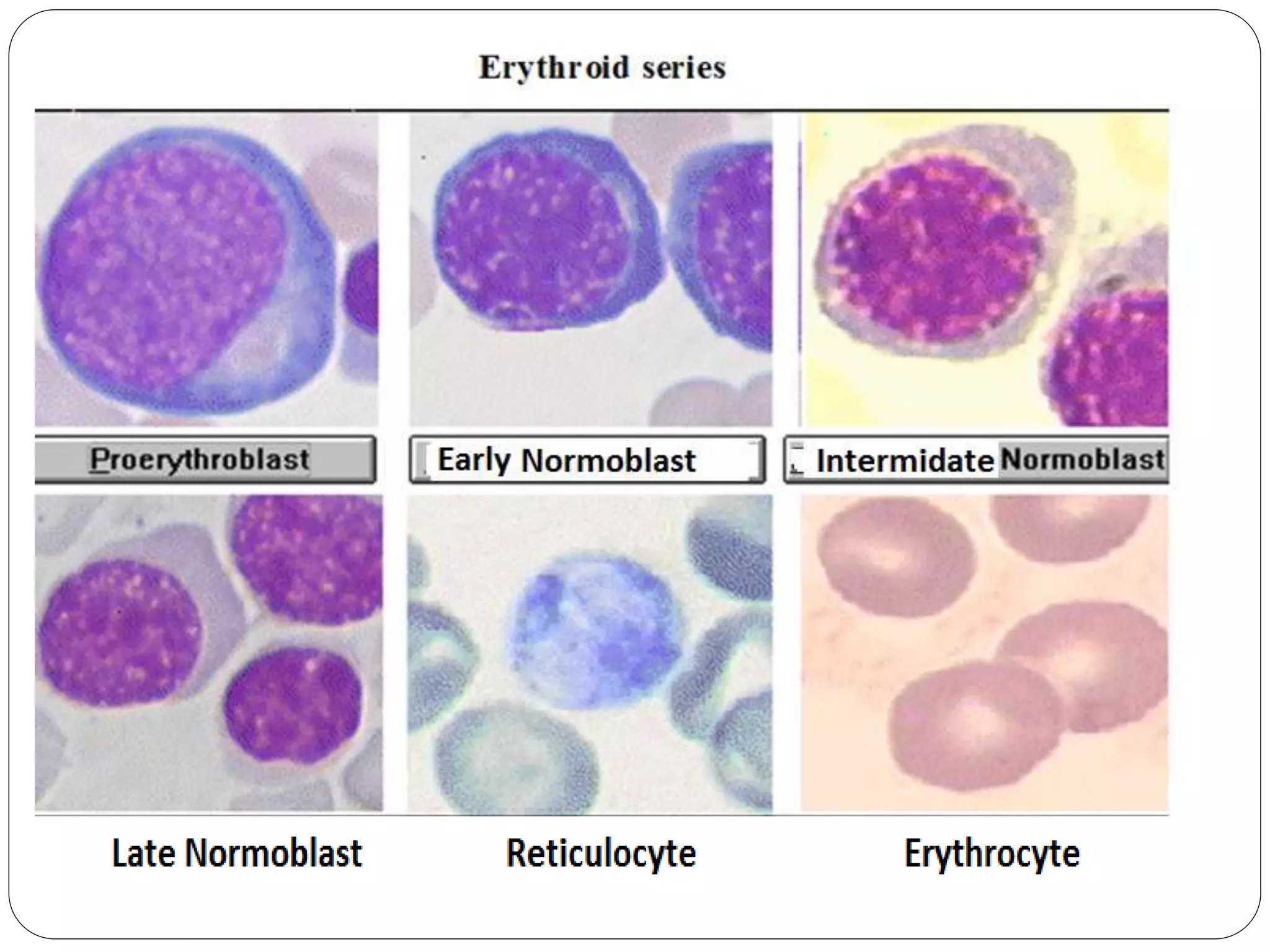 Red Blood Cells Production- Erythropoiesis.ppt | Blood Disorders ...