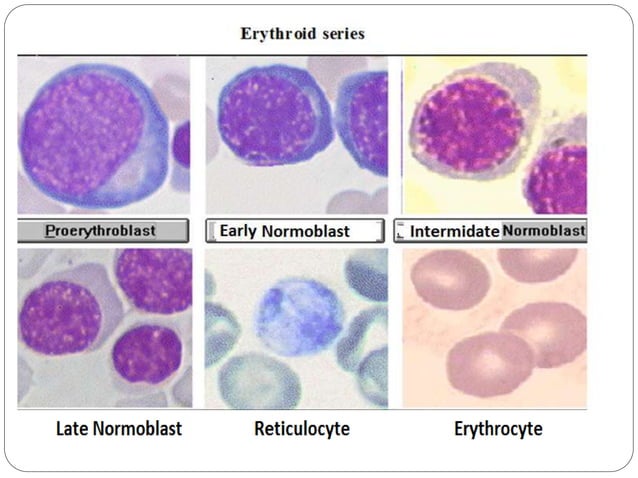 Red Blood Cells Production- Erythropoiesis.ppt | Blood Disorders ...