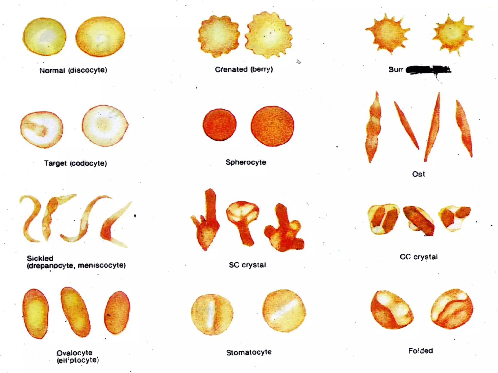 Red blood cell variation. | PPT