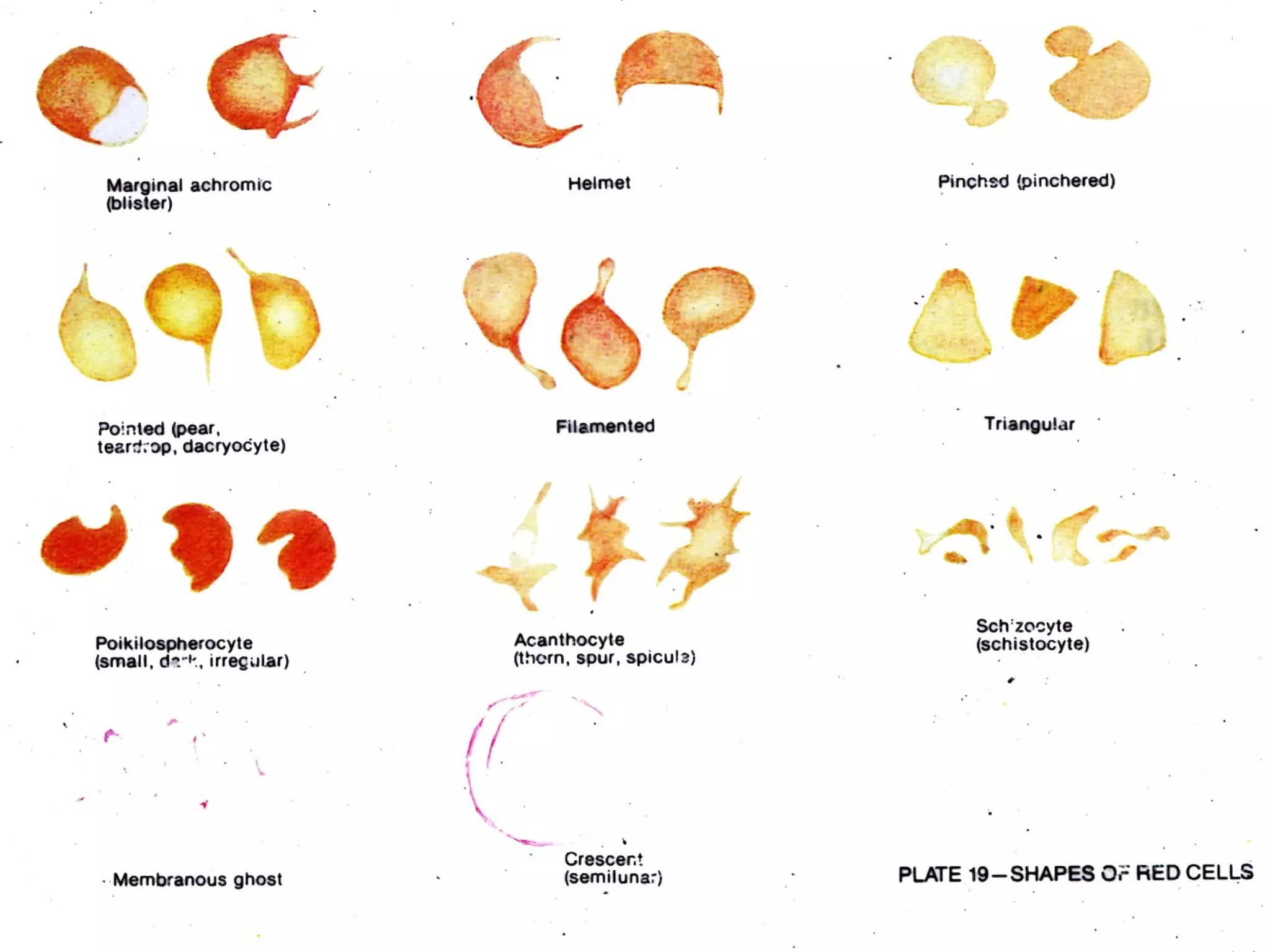 Red blood cell variation. | PPT