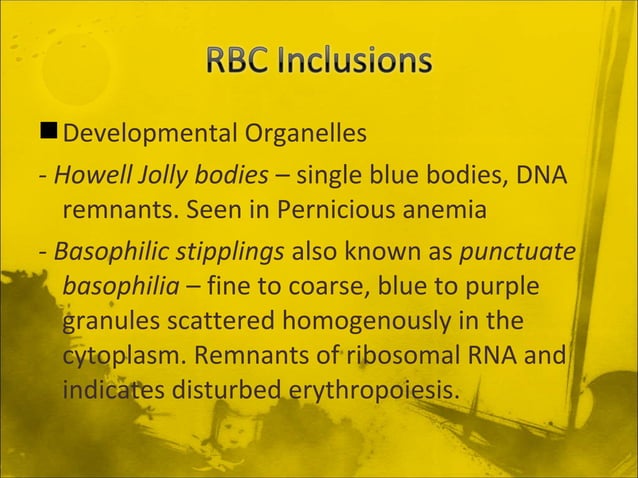 Red blood cell variation | PPT