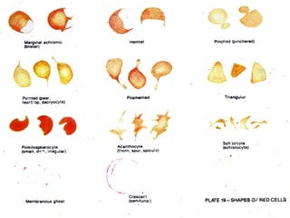 Red blood cell variation | PPT
