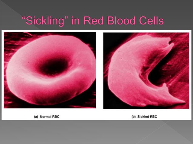 Red blood corpuscles class 9 | PPTX | Blood Disorders | Diseases and ...
