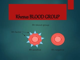 RED CELL ALLOIMMUNIZATION by Dr. Zamiul Hasan Fahim.pptx