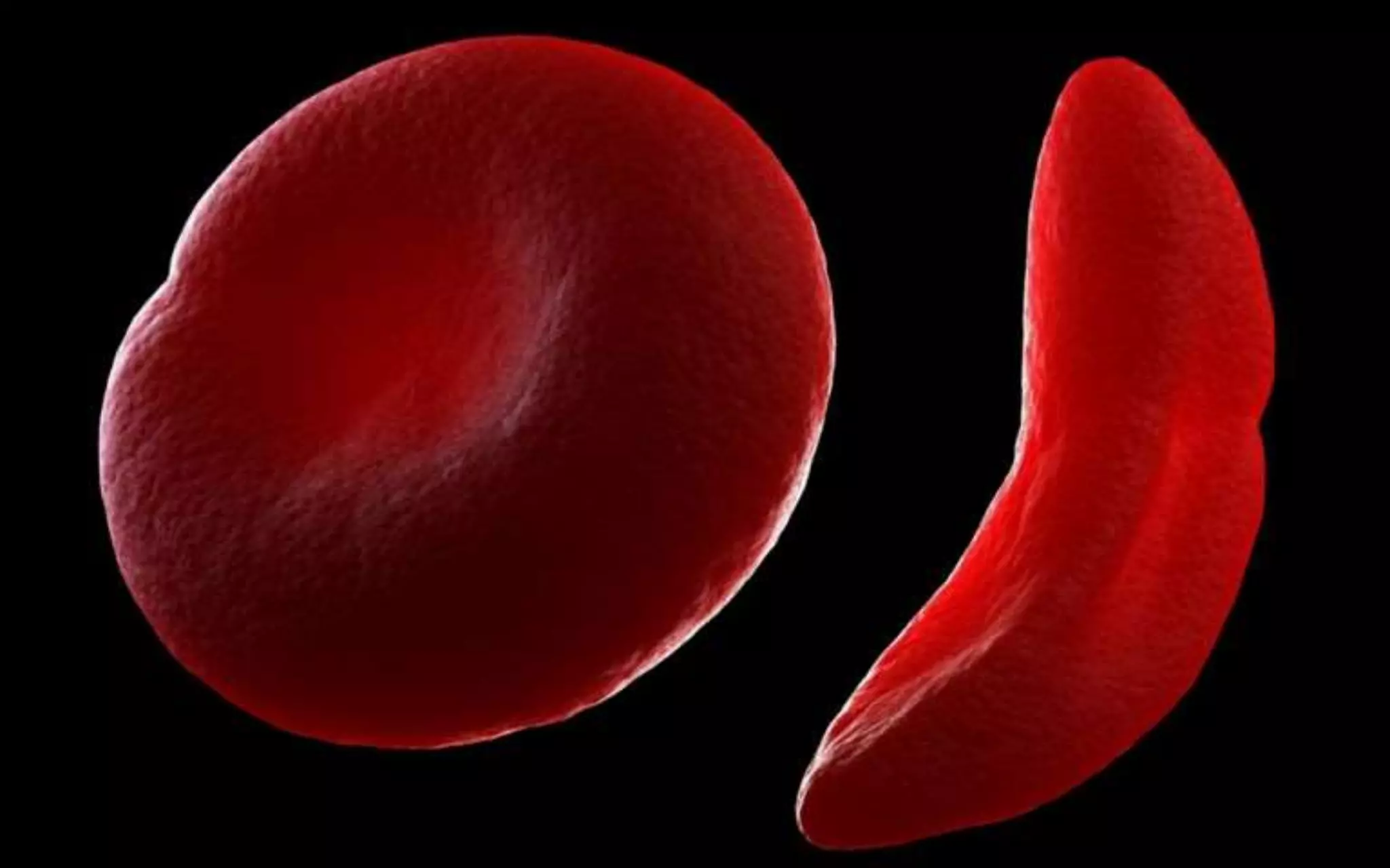 Red Cell Physiology & Pathophysiology of Sickle Cell Disease | PPTX