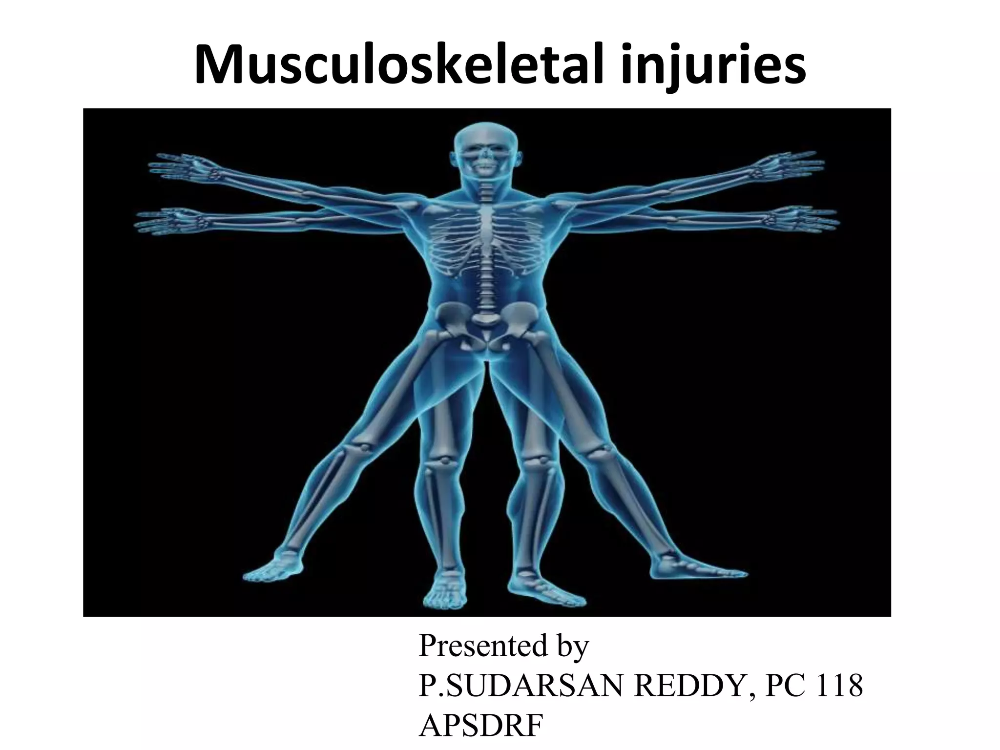 musculo skeletal injuries | PPT