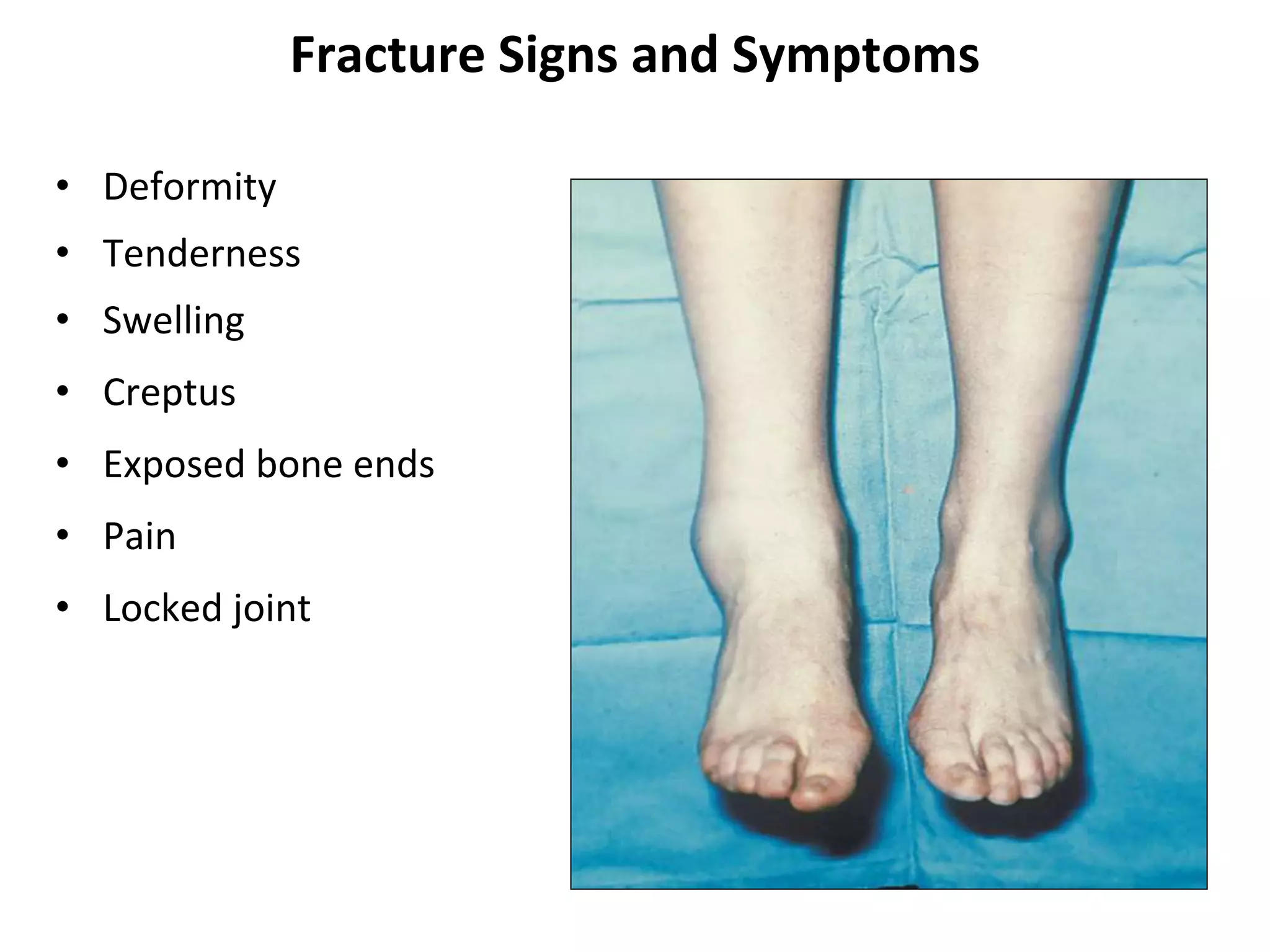 musculo skeletal injuries | PPT