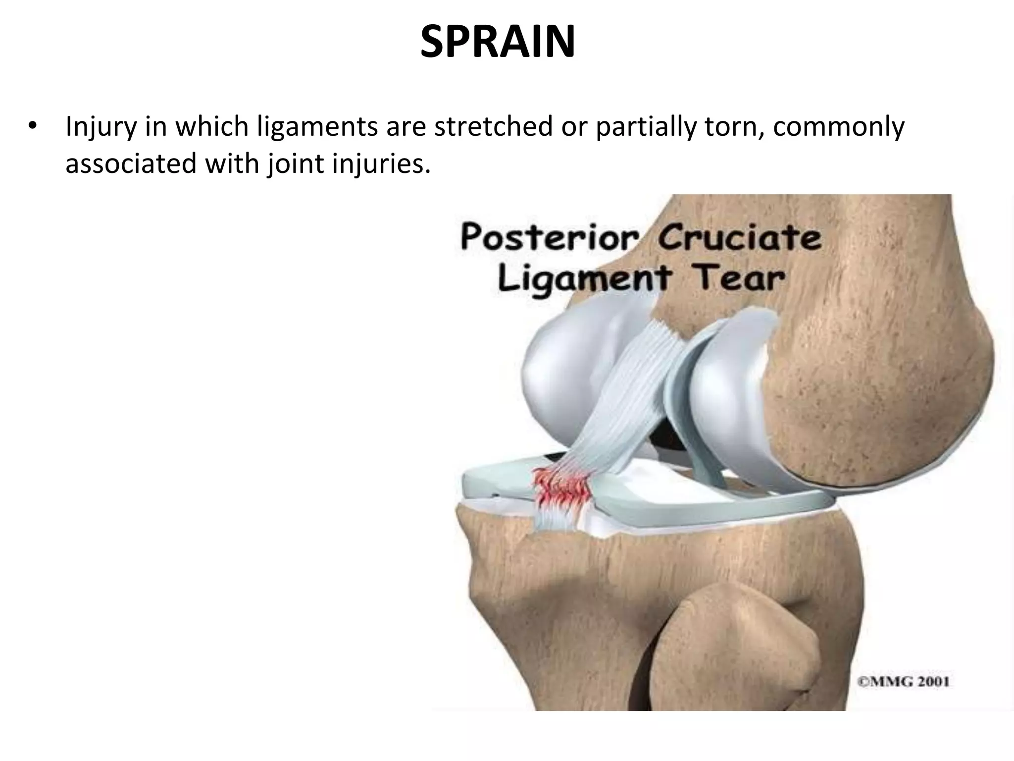 musculo skeletal injuries | PPT