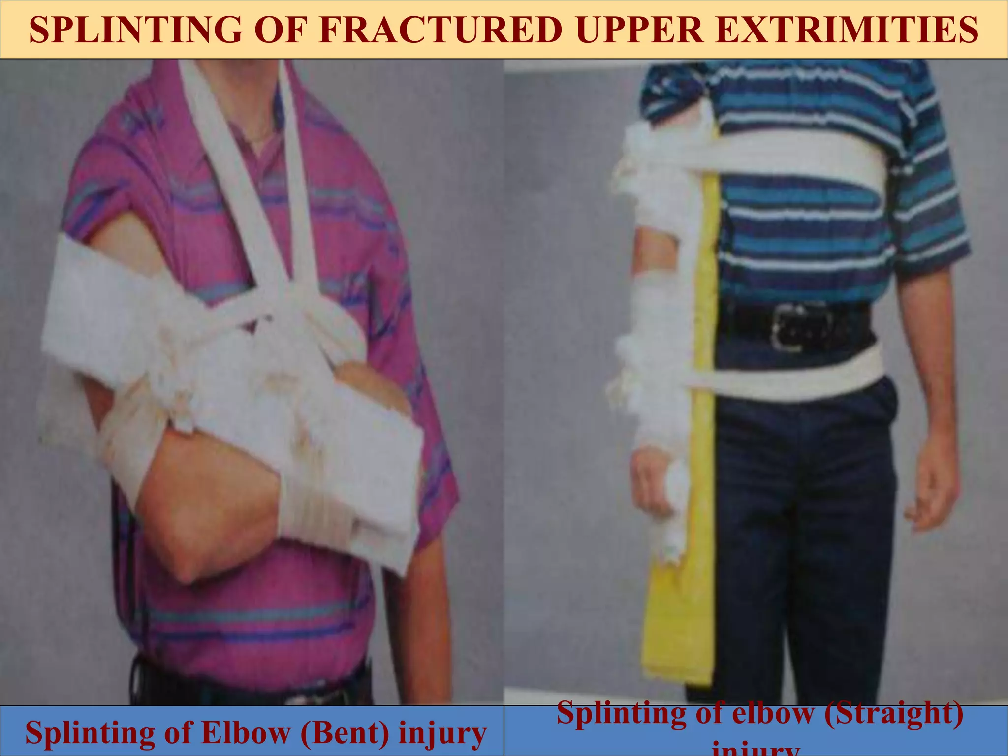 musculo skeletal injuries | PPT