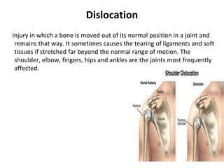 musculo skeletal injuries | PPT