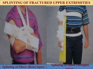 musculo skeletal injuries | PPTX
