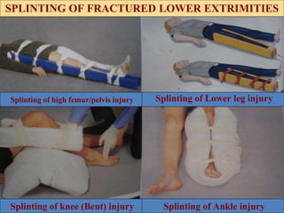 musculo skeletal injuries | PPT