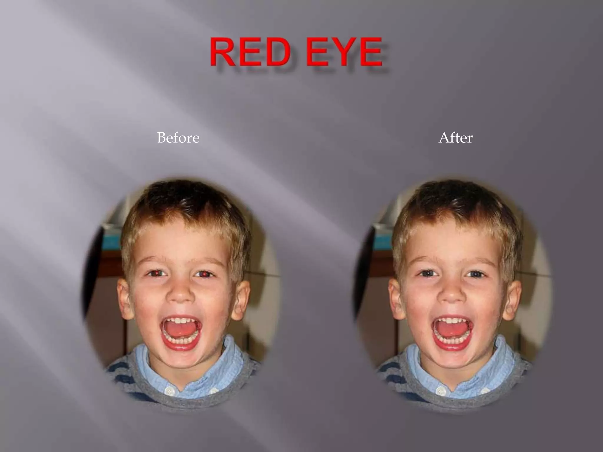Red eye/Smart erase PowerPoint | PPTX