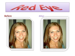 Red eye | PPT
