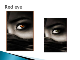 Red eye | PPT