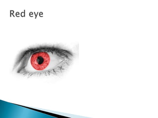 Red eye | PPT