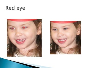 Red eye | PPT