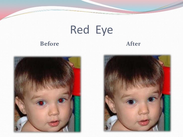 Red Eye Powerpoint Presentation