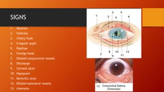 Red eye | PPT
