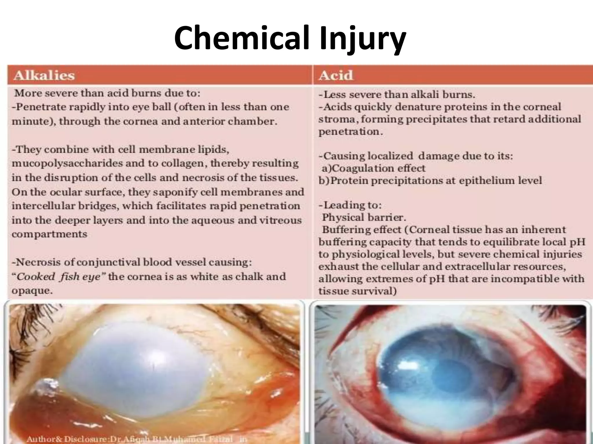 Red eye syndrome | PPSX