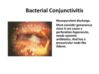 Red eye syndrome | PPSX