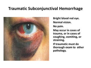 Red eye syndrome | PPSX
