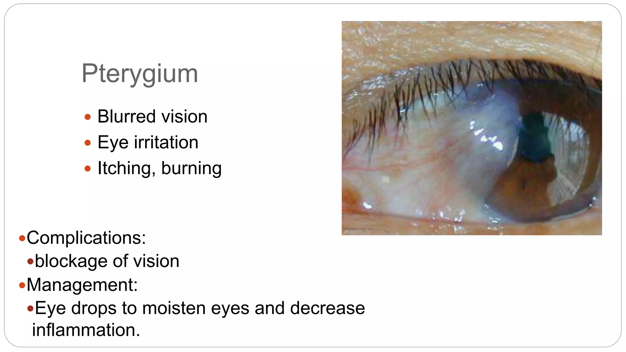 Approach to Red Eye.pptx