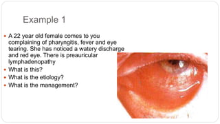 Approach to Red Eye.pptx