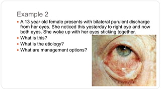 Approach to Red Eye.pptx