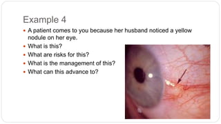 Approach to Red Eye.pptx