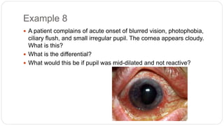 Approach to Red Eye.pptx