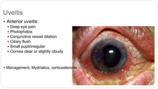Approach to Red Eye.pptx