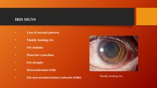 Red Eye.pptx