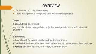RED EYE Public health Publication for IPC | PPT