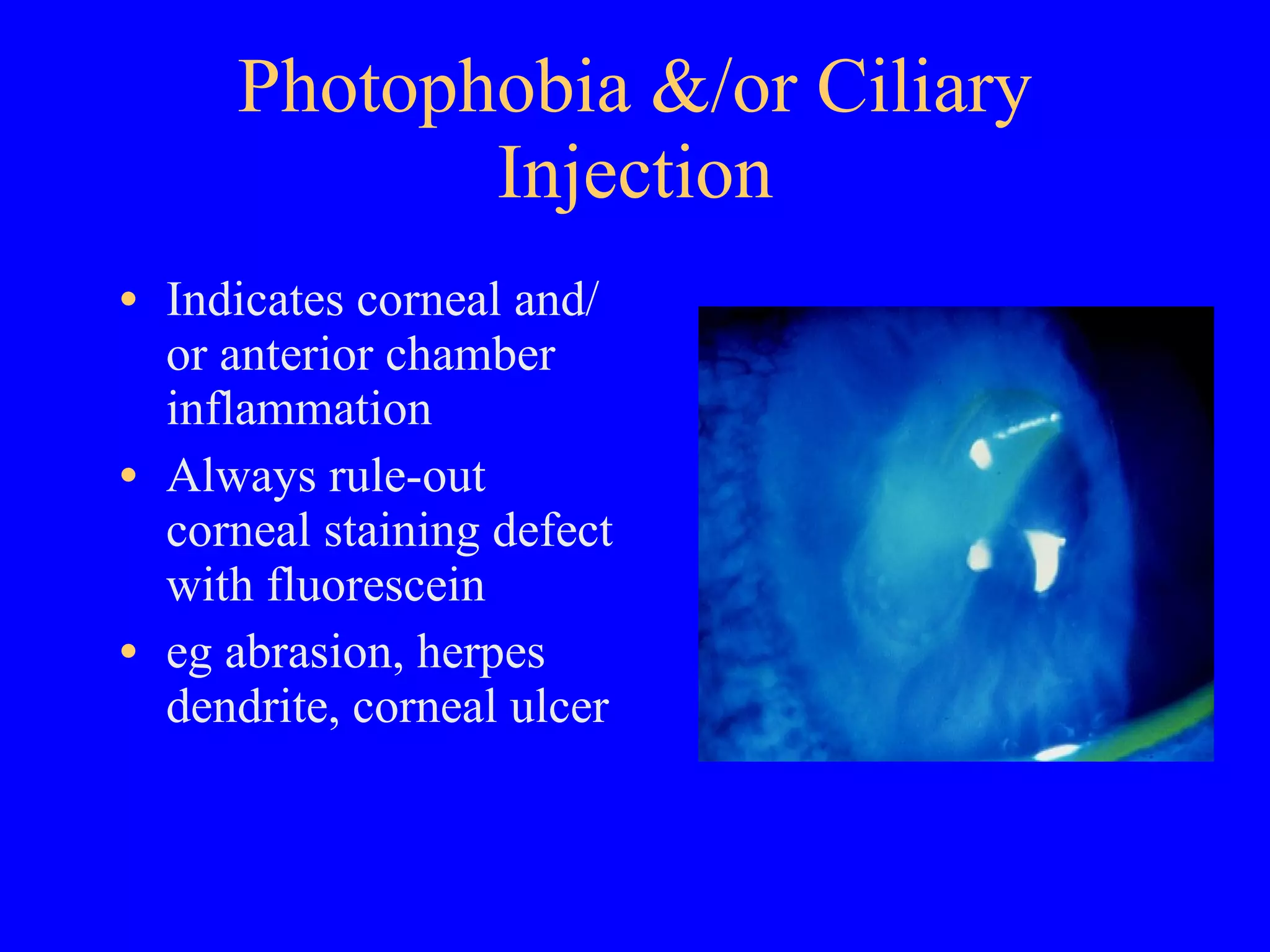 Red eye dr-s_brodovsky | PPT