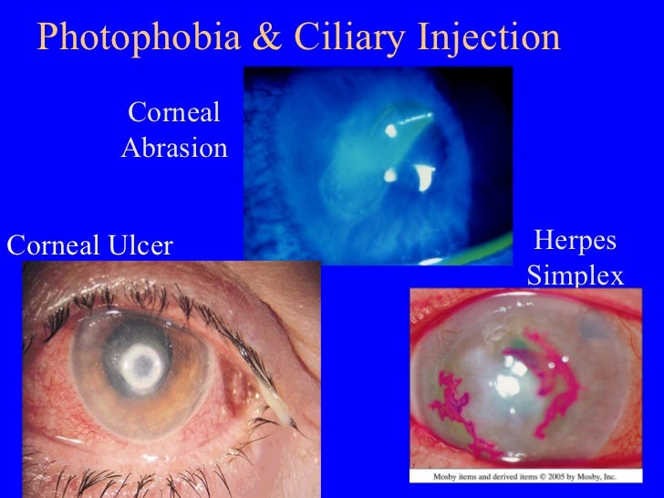 Red eye dr-s_brodovsky