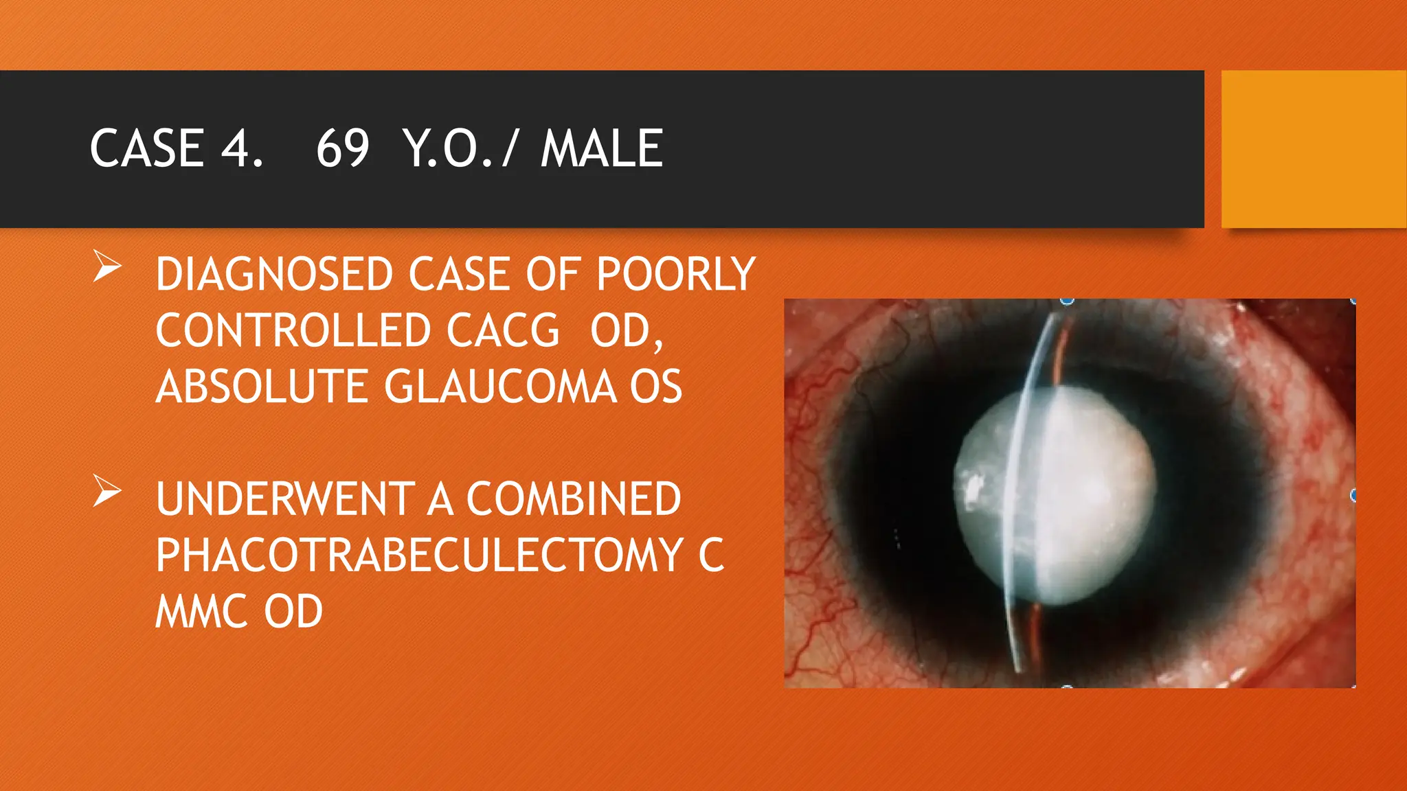 RED EYE AND ACUTE ANGLE CLOSURE GLAUCOMA.pptx