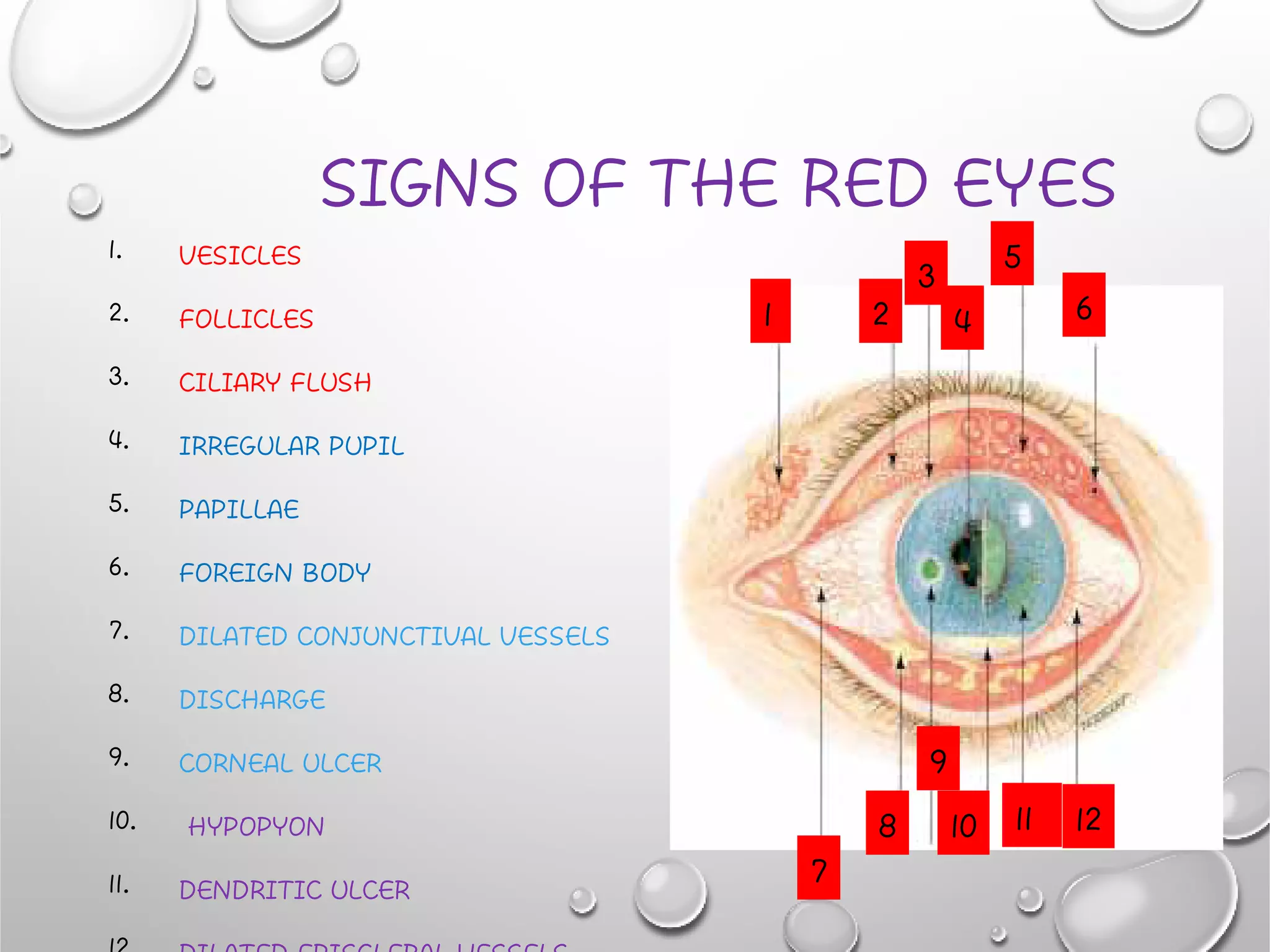 Red eye by manojit | PPT