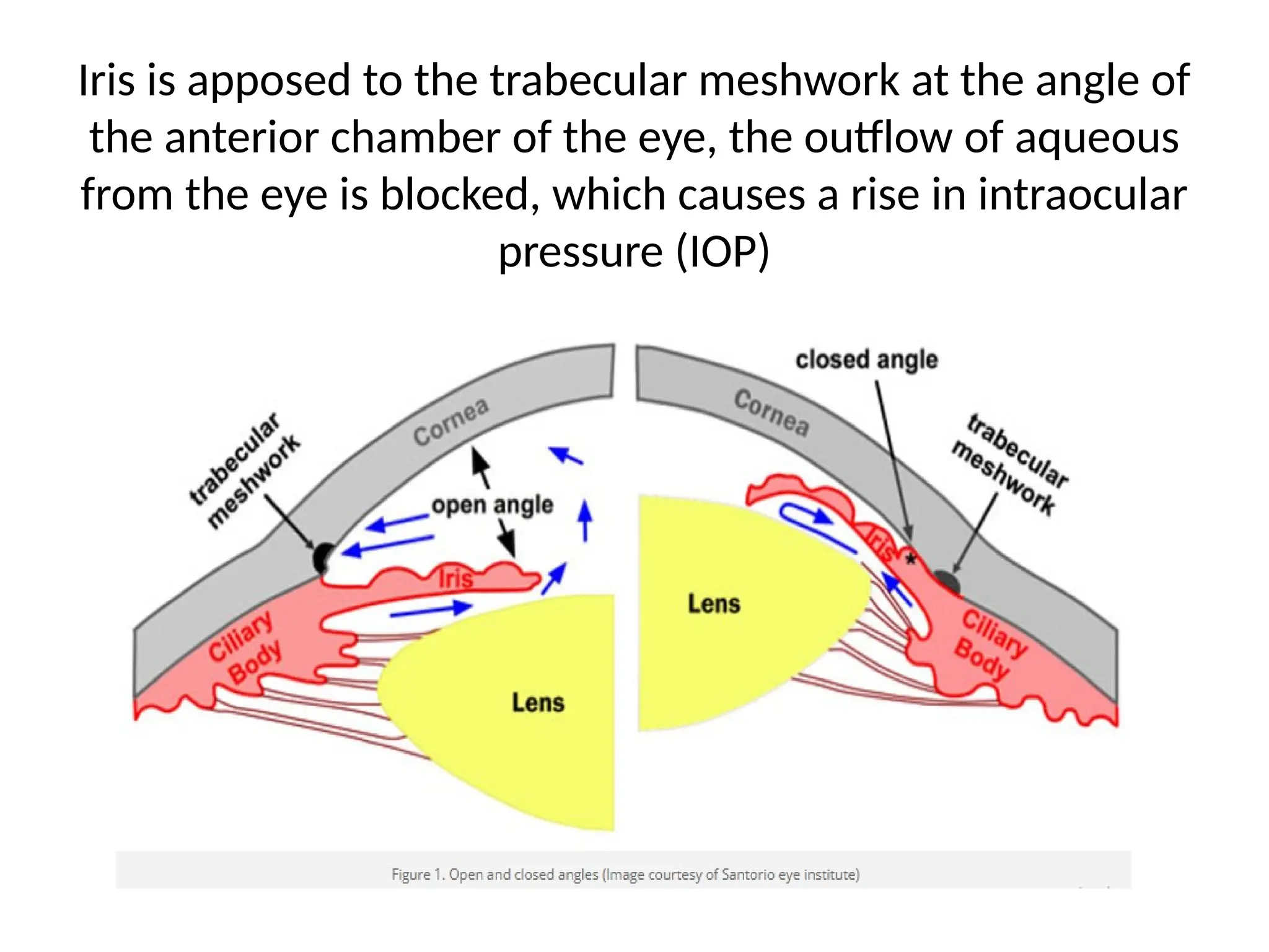 RED EYE in ophthalmology and its causess | PPT