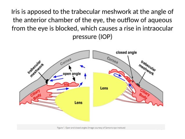 RED EYE in ophthalmology and its causess | PPT