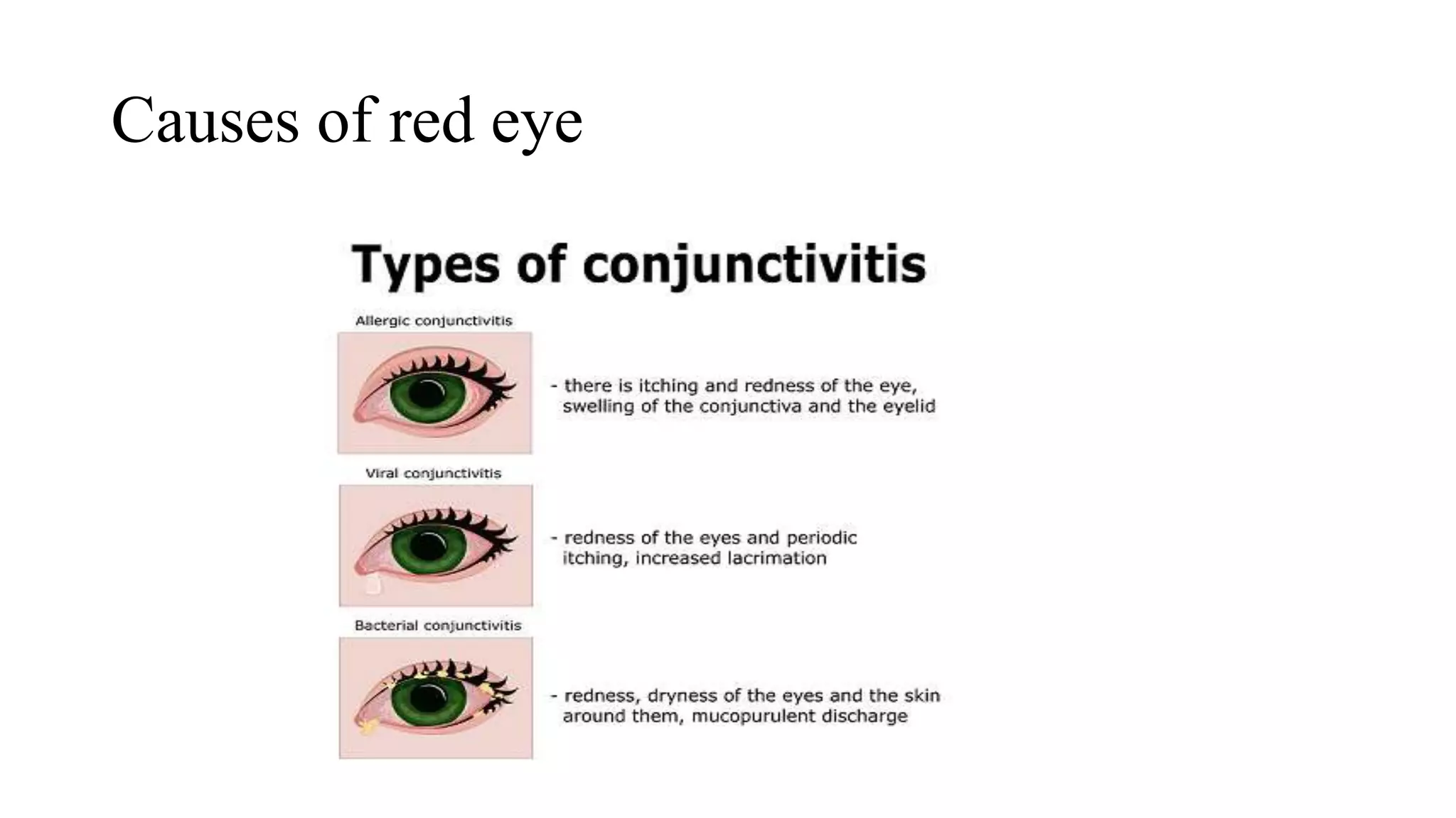 Red Eye - Common Causes, Diagnosis and Treatment.pptx