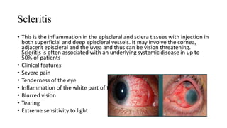 Red Eye - Common Causes, Diagnosis and Treatment.pptx