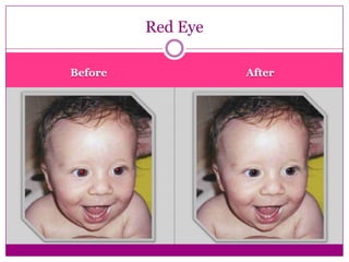 Red Eye/ Smart Erase Power Point Project | PPTX