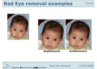 Red Eye Removal | PPT